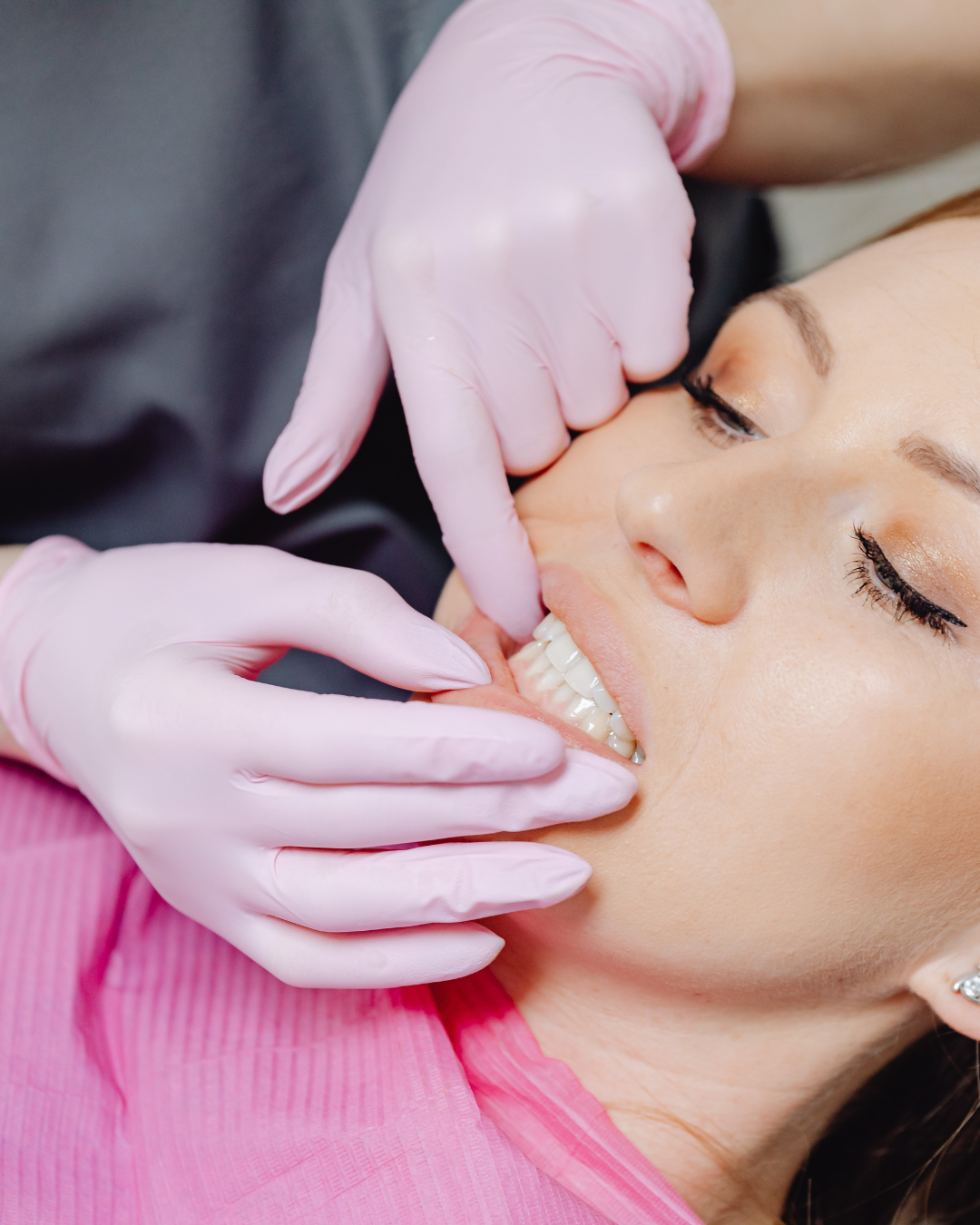 Gum Grafting After Dental Implants - District Dental Surgery